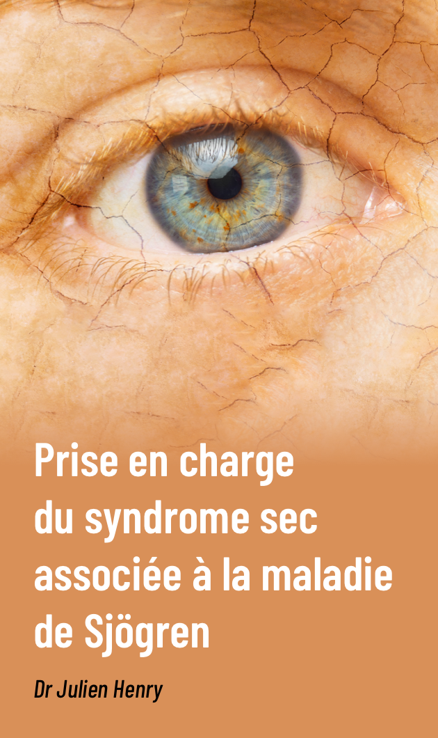 Prise en charge du syndrome sec - Rhumatos